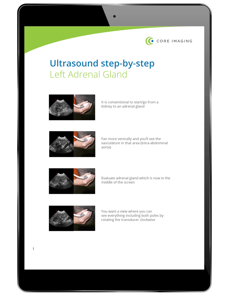 Step-by-Step Ultrasound Guide: Left Adrenal Gland