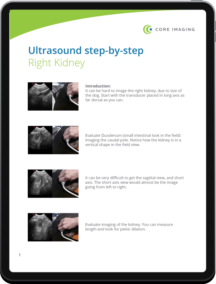 Step-by-Step Ultrasound Guide: Right Kidney